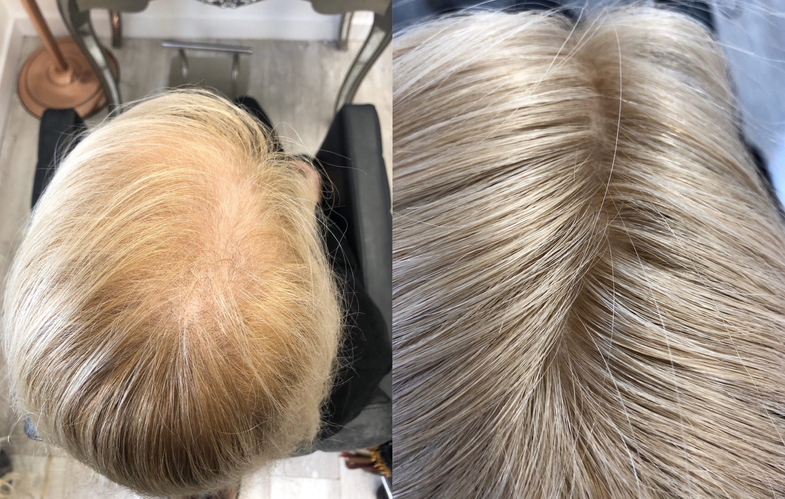 Gallery - Lacy Locks