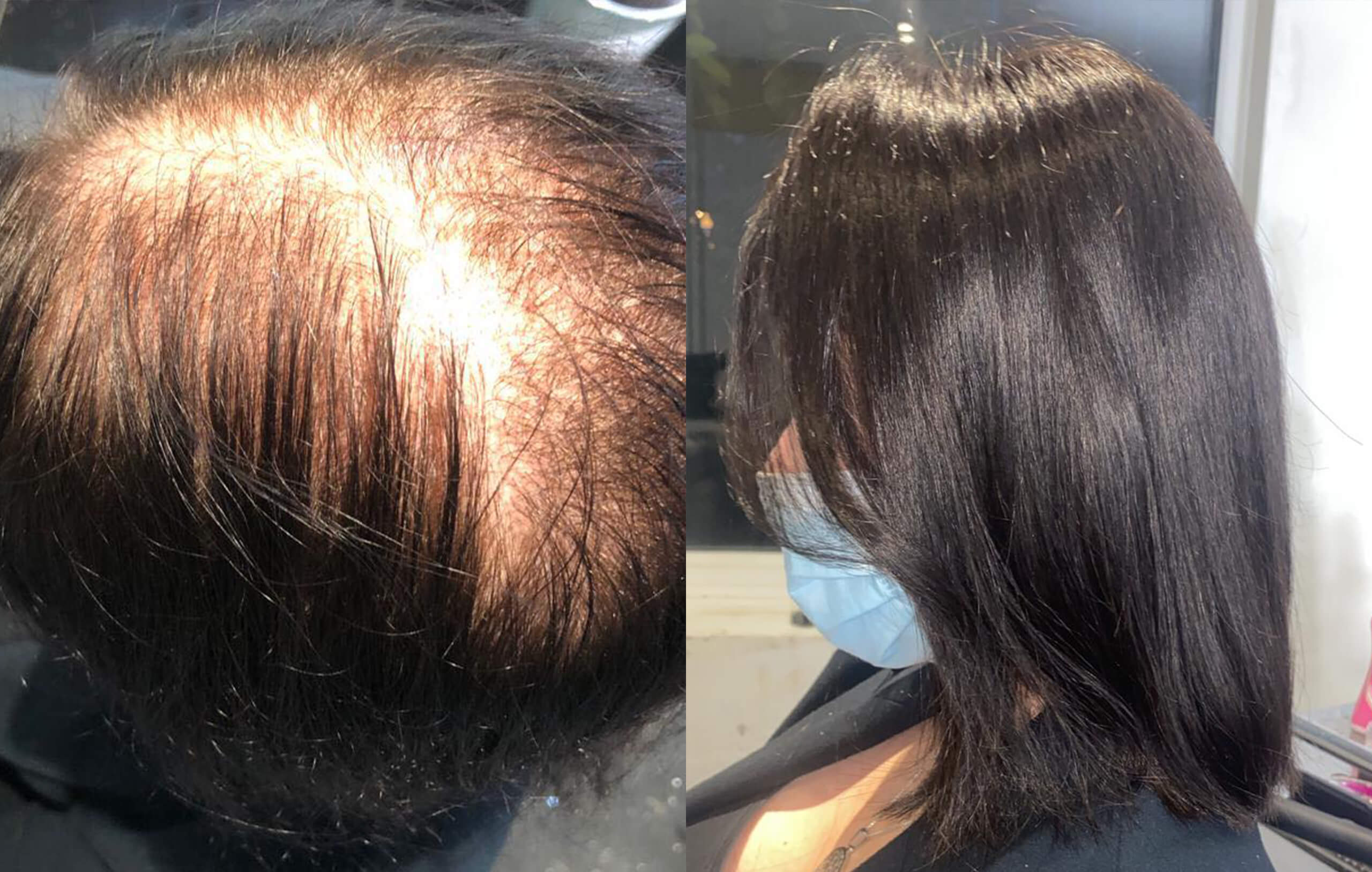 Gallery - Lacy Locks