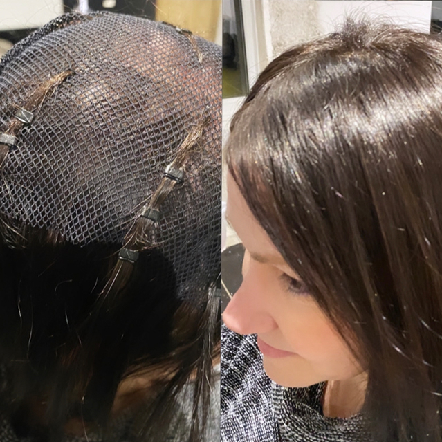 Mesh Integration For Thinning Caused By Pregnancy