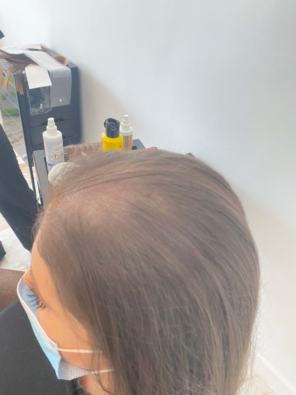 Hair Transformation With Mesh Integration System - Lacy Locks